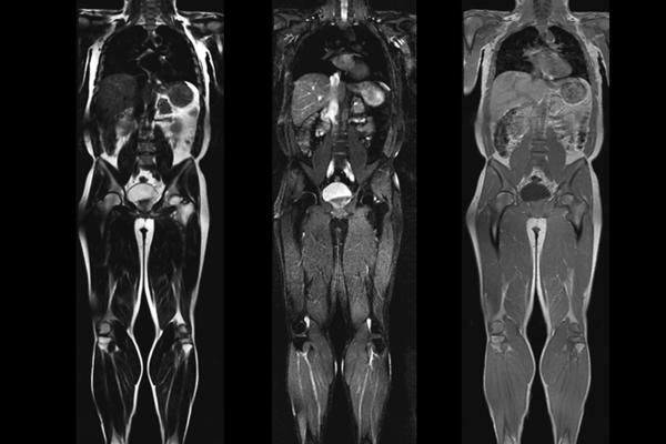 APERTO Lucent with SynergyDrive : Imaging | Fujifilm [Singapore]